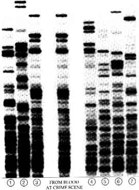 Dna Fingerprinting Crime Scene